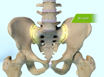 Sacroiliac Joint Dysfunction Springfield OR | Oregon Neurosurgery