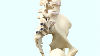 Sacroiliac Joint Dysfunction Springfield OR | Oregon Neurosurgery